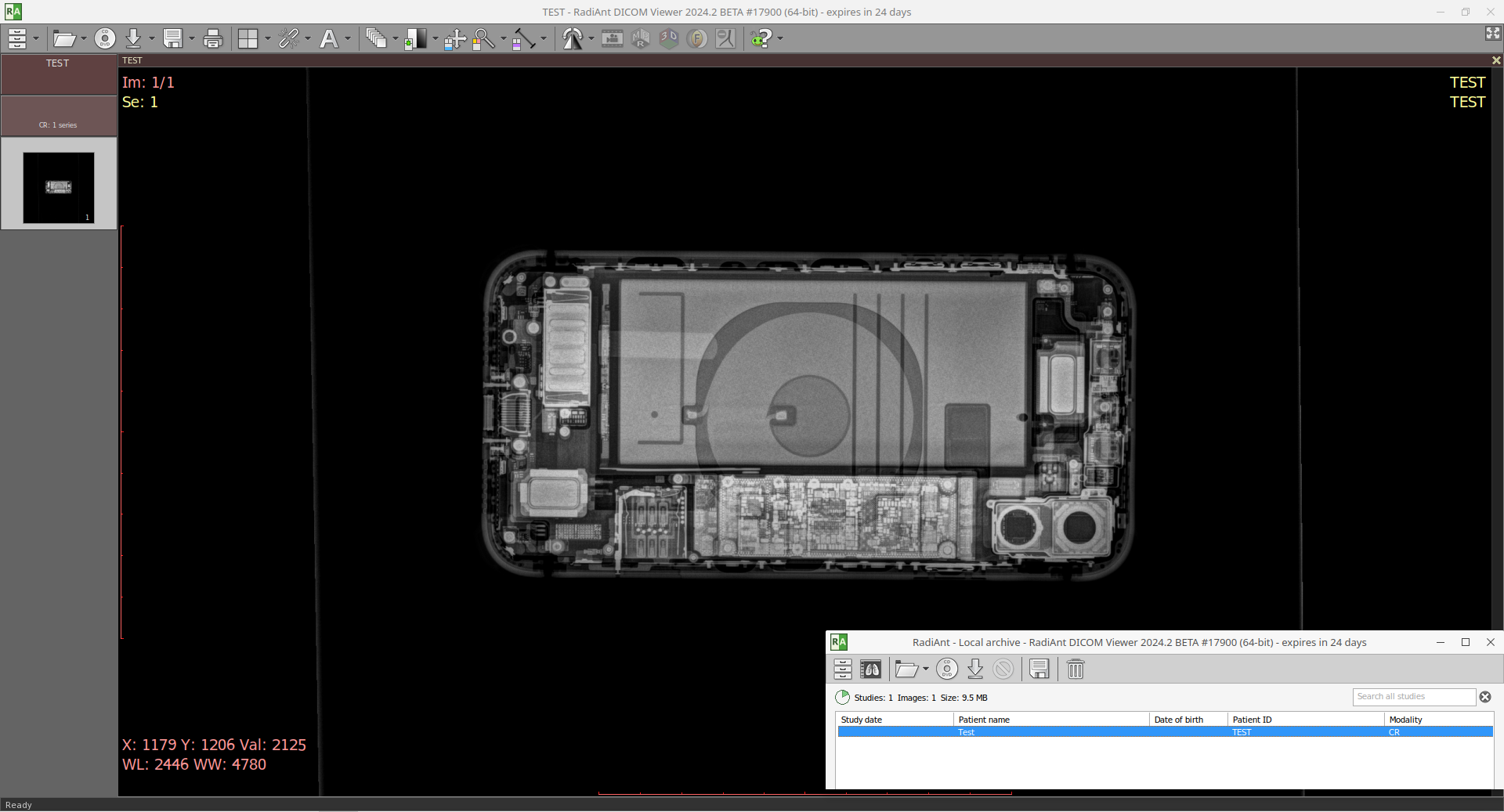 Radiant Dicom Viewer